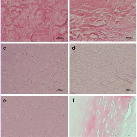 The Characteristic D Periodic Banded Structure Of Native Collagen Type