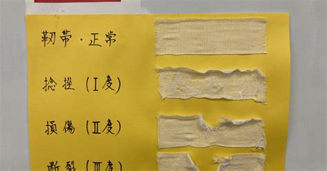 捻挫 と靭帯損傷と靭帯断裂 ‼ ブログ 江戸川区の整骨院・土肥接骨院で不調を癒す