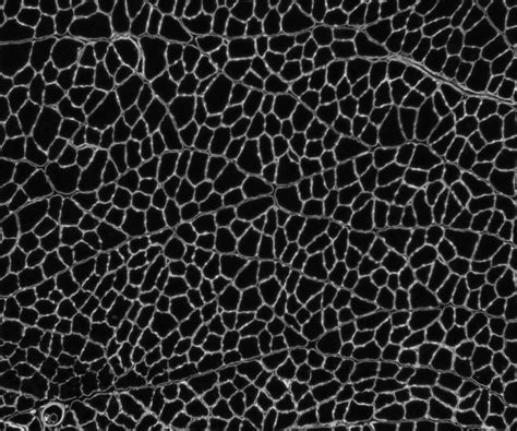 Truefad True Fiber Atrophy Distinction Myotube And Muscle Fiber Segmentation Announcements