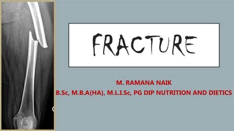 Fracture Pptx First Aid Management Notes Pptx
