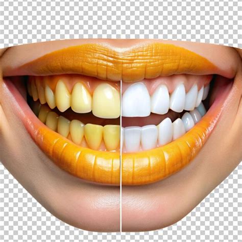 Tooth Whitening Psd High Quality Free Psd Templates For Download Freepik