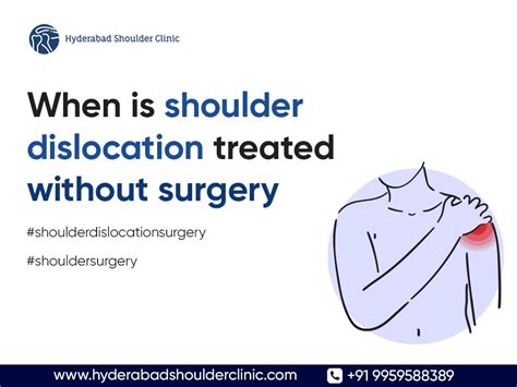 When Is Shoulder Dislocation Treated Without Surgery Shoulder Clinic