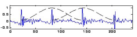 matlab find pitch synchronous windowing based on pitch tracking