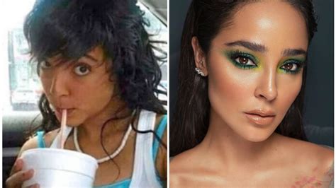 Yeri Mua Manelyk Karely Ruiz And Mona Before And After Their Surgeries Photos Celebrity