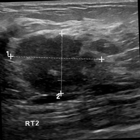 Object Segmentation Object Detection Dataset And Pre Trained Model By Ica Afif