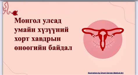 Умайн хүзүүний хорт хавдар МэндСаруул Өрх 15 р хороо