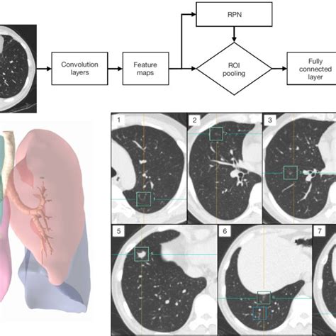 the framework of the deep learning powered pulmonary nodule detection