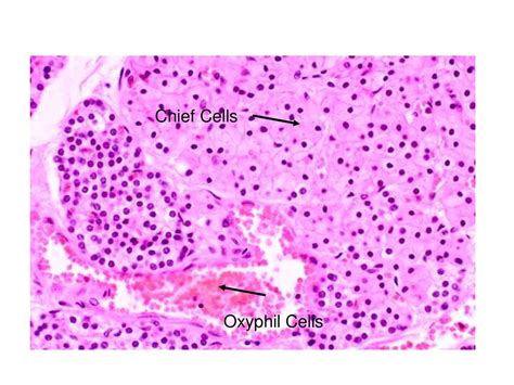 Endocrine Lab Exercise Ppt Download Endocrine Lab Exercise Ppt Download