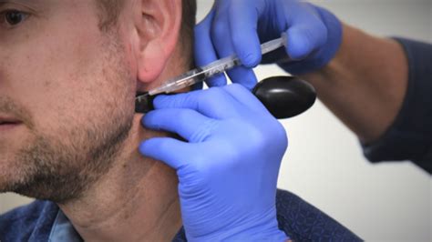 Why Introduce Trigger Point Injections To Your Practice Nierman Practice Management