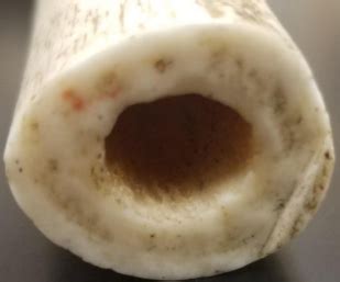 A P Lab Osseous Tissue And Bone Markings Flashcards Quizlet