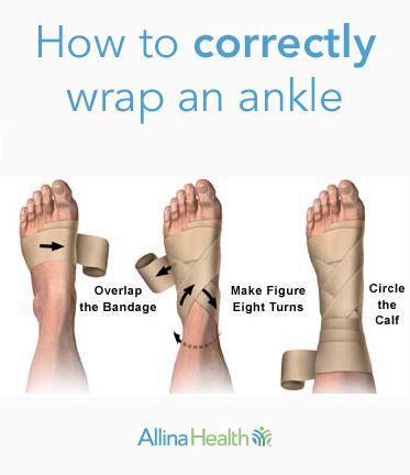 3 Steps For Wrapping An Ankle Sprained Ankle Medical Knowledge