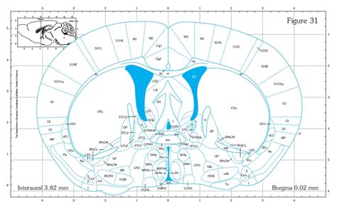 如何精准定位黑质，轻松找到目标脑区
