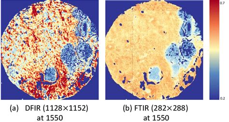 Msi And Hsi From Breast Tissue Taken By Dfir And Ftir Imaging Systems