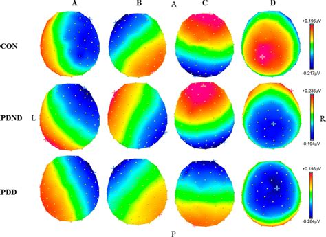 Four Scalp Topographical Template Maps Representing Resting Eeg