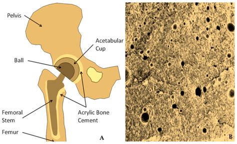 Schematic Representation Of Chp A And The Cements Electron