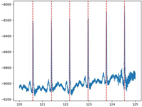 Real Time Peak Detection Mne Lsl