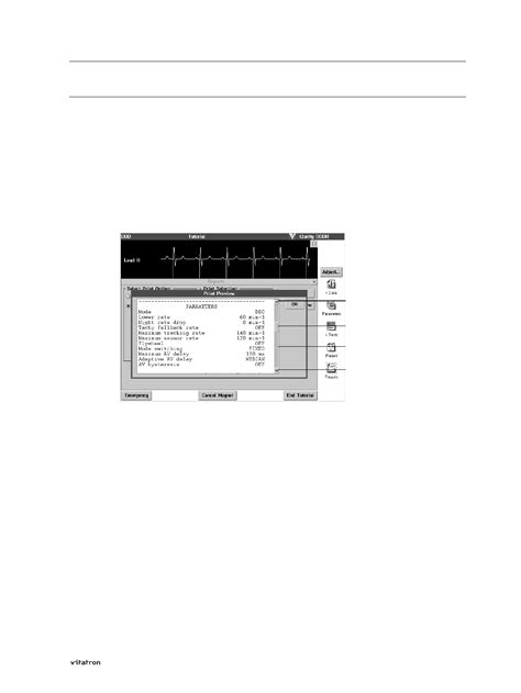 Medtronic 2090 Programming Guide