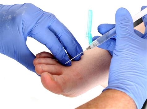 Foot Injection Therapy Feet In Motion Foot Injection Therapy Feet In Motion