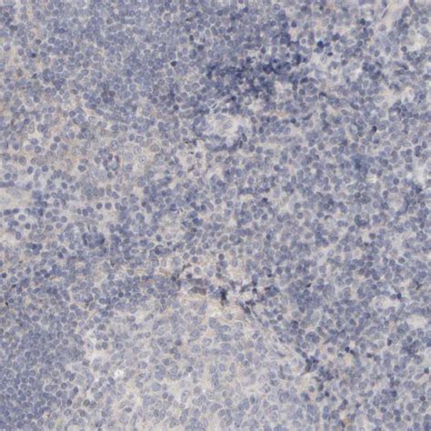 Anti Mst1 Human Protein Atlas Antibody
