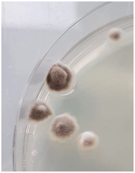 Recurrent Subcutaneous Phaeohyphomycosis Due To Medicopsis Romeroi A Case Report In A