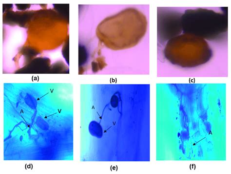 Arbuscular Mycorrhizal Fungal Spores Of Different Glomus Spp Download Scientific Diagram