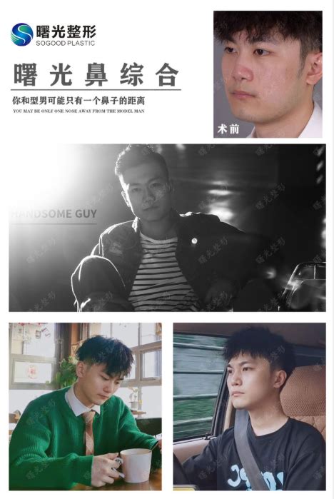 想做鼻子又不清楚价格？带你了解隆鼻需要多少钱~烟台哪里做隆鼻好？ 知乎