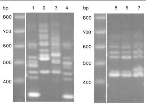 Staphylococcus Haemolyticus Semantic Scholar