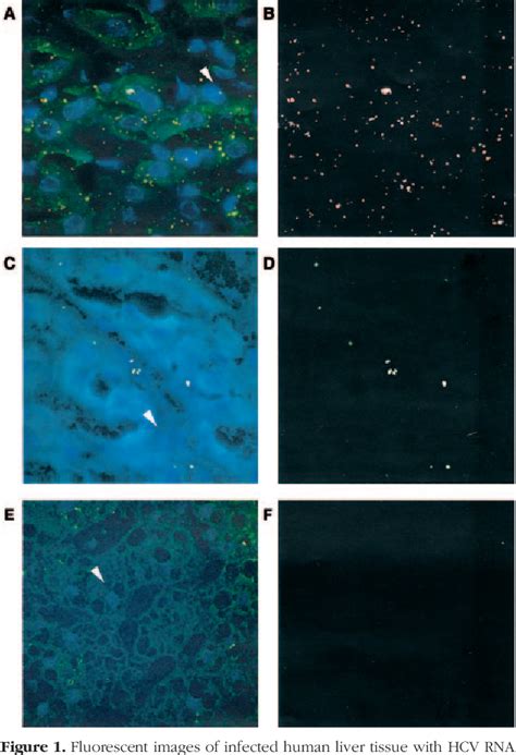 Figure 1 From Dynamics Of Hepatitis C Virus Replication In Human Liver