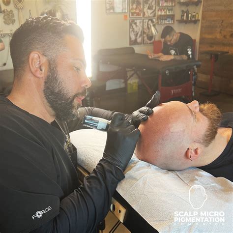 Enhancing Lives With Smp Remarkable Benefits And Transformations