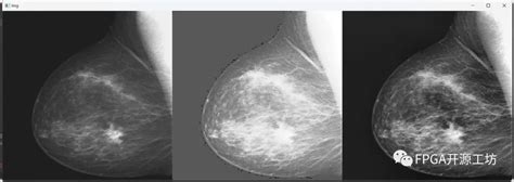 Fpga实现clahe算法verilog 知乎 Fpga实现clahe算法verilog 知乎