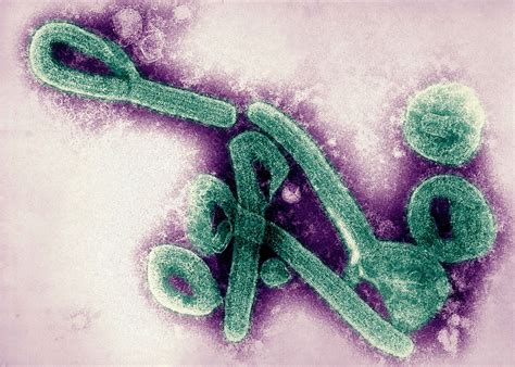 Marburg Virus Treatment Marburg Virus United States Pdf Ppt
