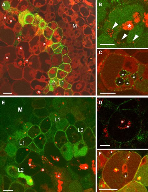 Localization Of The Nod Factor Receptors In Nodules At 10 To 14 Dai Download Scientific Diagram