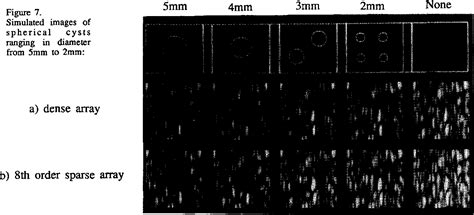 figure 1 from simulation of b scan images from two dimensional transducer arrays semantic scholar