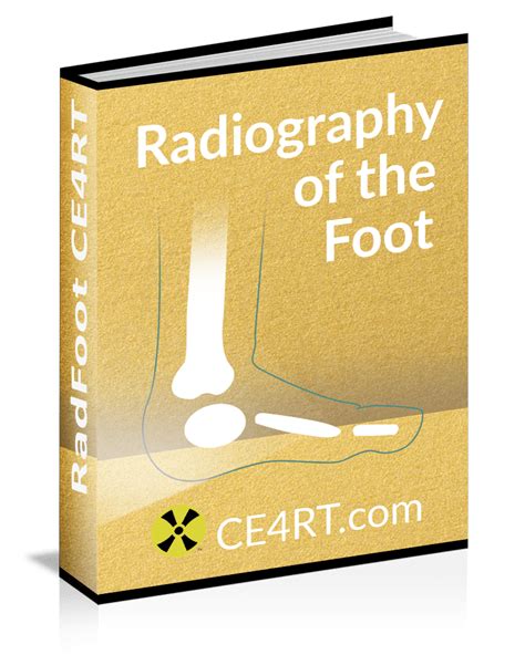 Ce4rt Information On Stochastic Effects Of Radiation For X Ray Techs