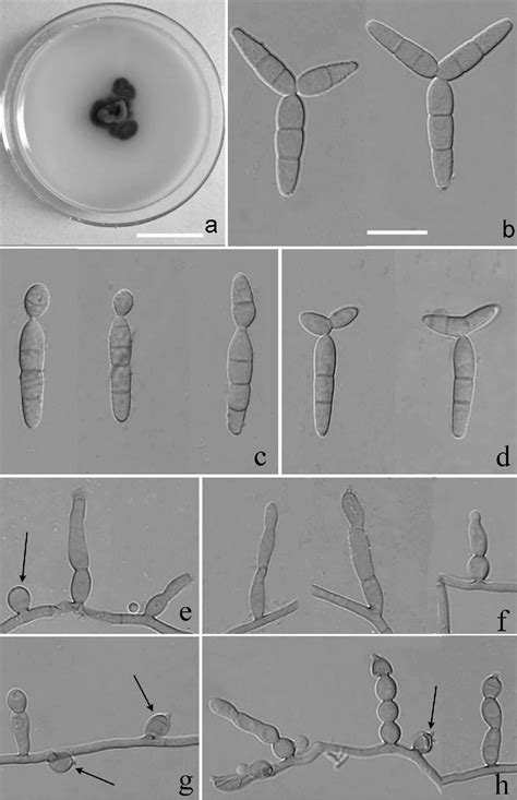 Scolecobasidium Semantic Scholar