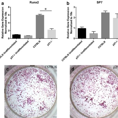 Runx2 A And Sp7 B Gene Expression In C57bl6 And P21 −− Bone