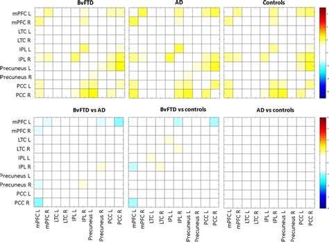 Non Significant Default Mode Network Dmn Connectivity P 005 Fwe Download Scientific