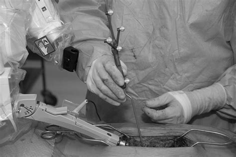 Intra Operative Photo Depicting The Use Of A Passive Planar Probe To Download Scientific