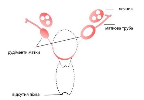 Операції при аномаліях розвитку