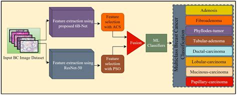 Jpm Free Full Text Multi Class Classification Of Breast Cancer Using 6b Net With Deep