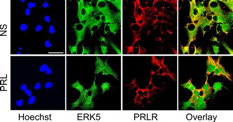 Extracellular Signal Regulated Kinase 5 Erk5 Mediates Prolactin