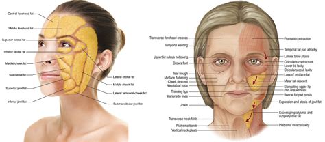 Temple And Forehead Fillers In Singapore Bay Aesthetics Clinic