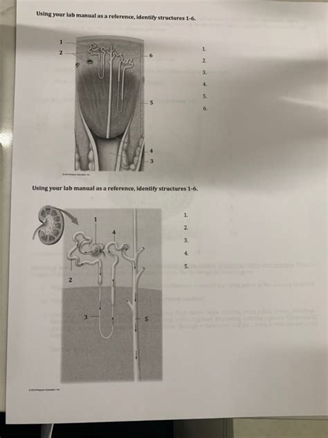 Solved Gross And Microscopic Anatomy Of The Urinary System