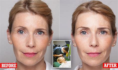 How To Fix Uneven Eyebrows 3 Methods Most Trusted By Many People Today