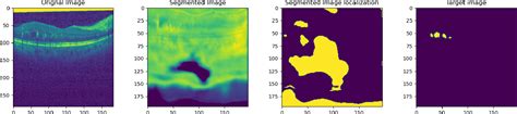 figure 4 from advanced retinal image segmentation using u net architecture a leap forward in