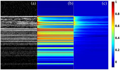 autocorrelation color maps a an oct m scan acquired from a porcine