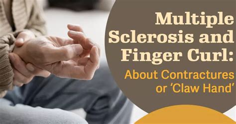 Multiple Sclerosis And Finger Curl About Contractures Or ‘claw Hand Mymsteam