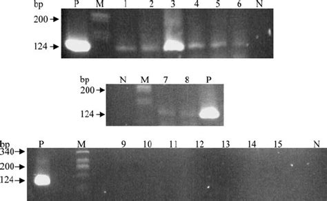 Detection Of Staphylococcus Epidermidis In High Impact Low Impact And