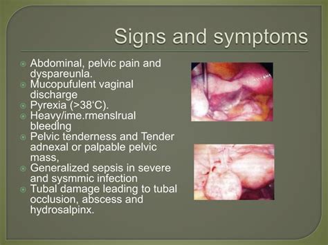 Genital Infections In Gynecology Pptx