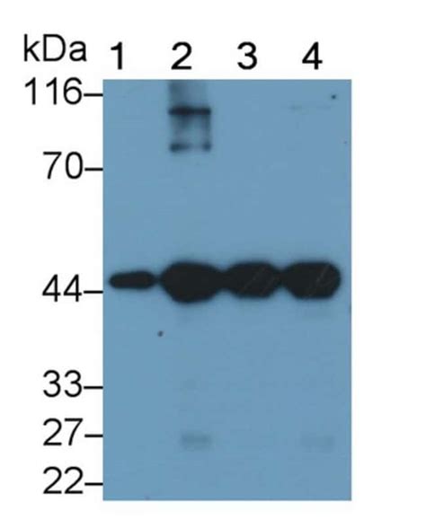 Alpha Cardiac Actin Monoclonal Antibody C302 Invitrogen 200 μl